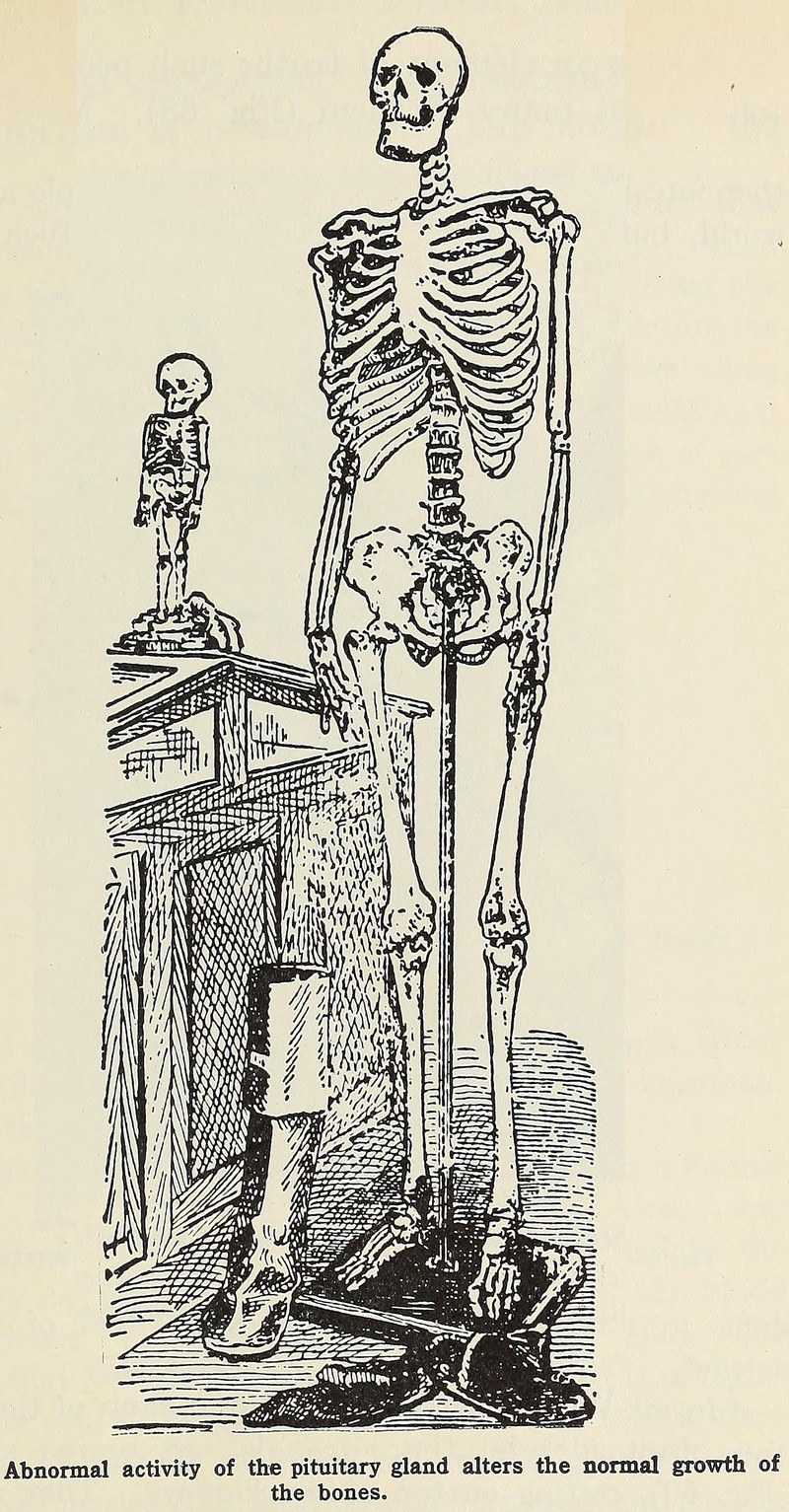 Abecedarian : posts tagged skeleton